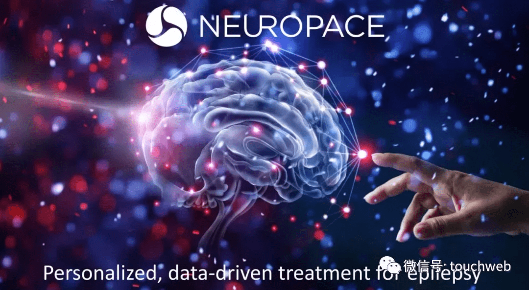脑神经治疗企业NeuroPace上市：上涨47% 市值5.6亿美元_持股