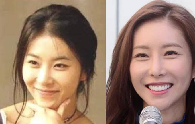 抗衰真相！为啥这些顶级女神的27岁到45岁全都凭空消失？_aump_面部_May