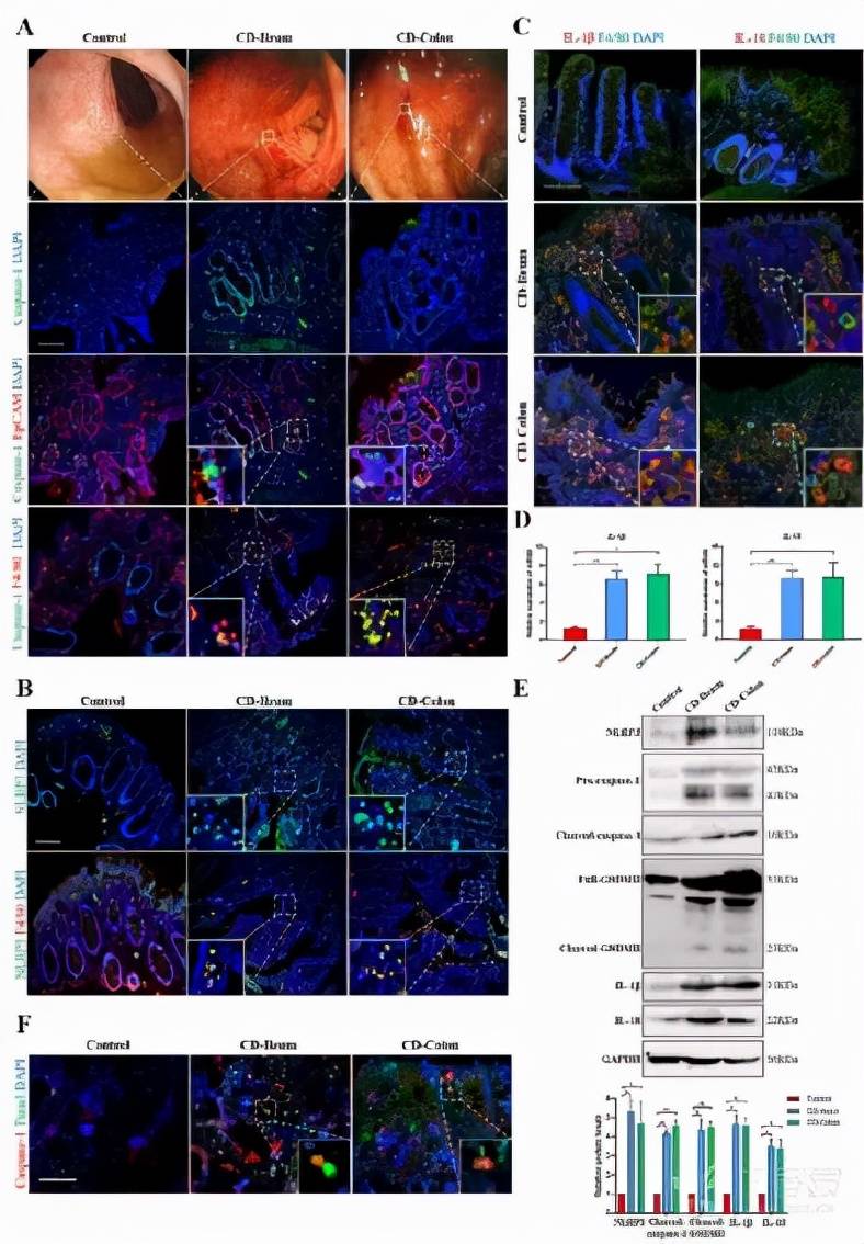 细胞焦亡的研究方法——高分文献解读_Mincle_世卫组织_克罗恩
