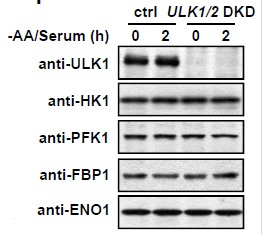蛋白质印迹（WB）实验的意义和步骤介绍_免疫_检测_样品