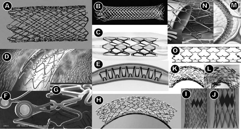 血管支架设计的十年演变_的设计_临床_成功