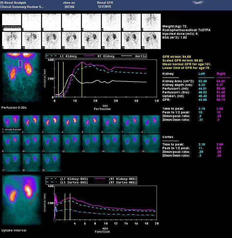 核医学科就医小常识—带您认识SPECT/CT_检查