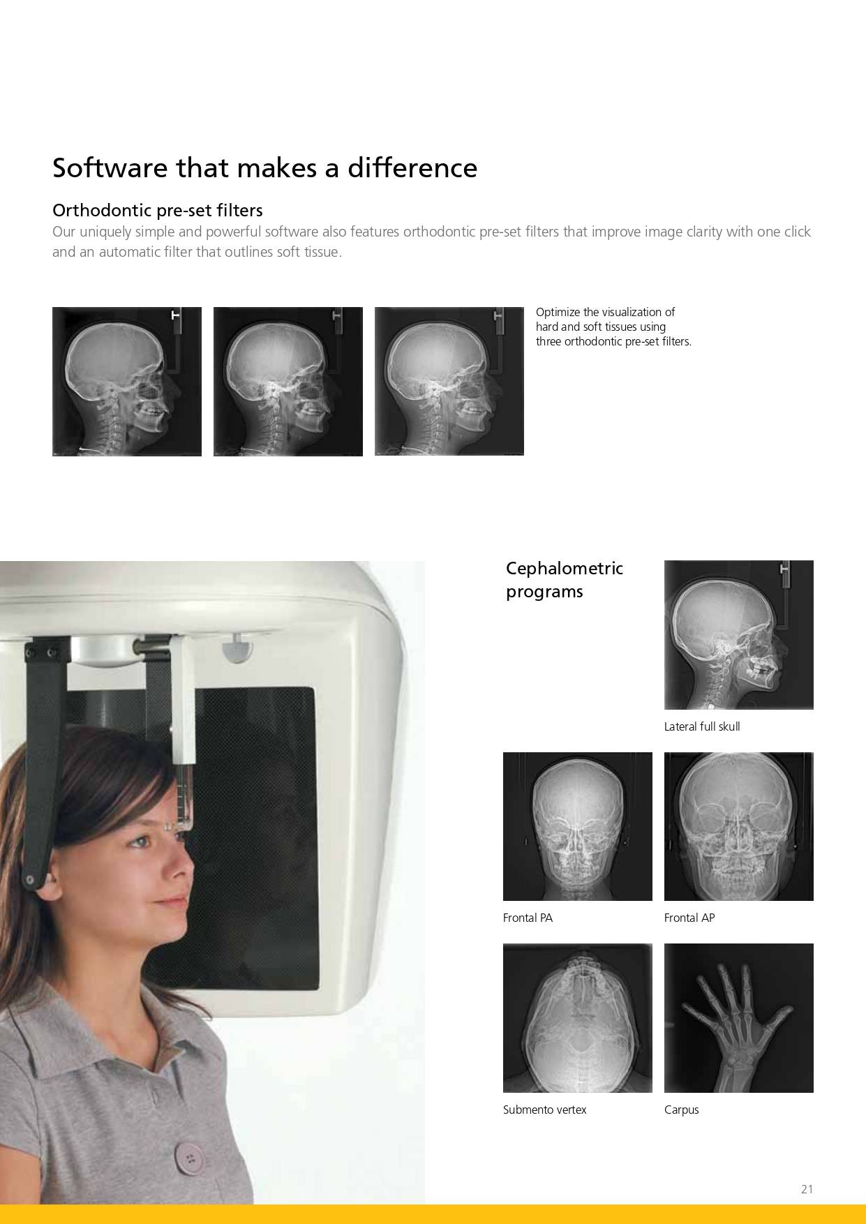 Carestream 9000-搜狐大视野-搜狐新闻