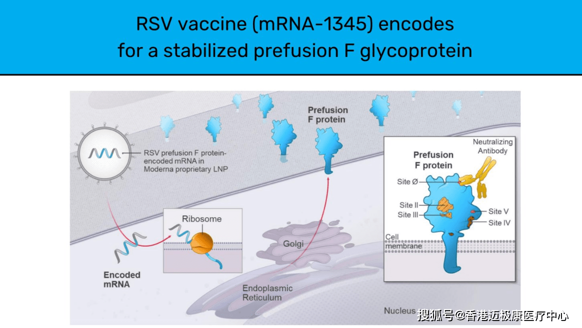FDA授予mRNA-1345突破性治疗指定，呼吸道合胞病毒 (RSV) 疫苗达八成以上效力_Moderna_试验_进行