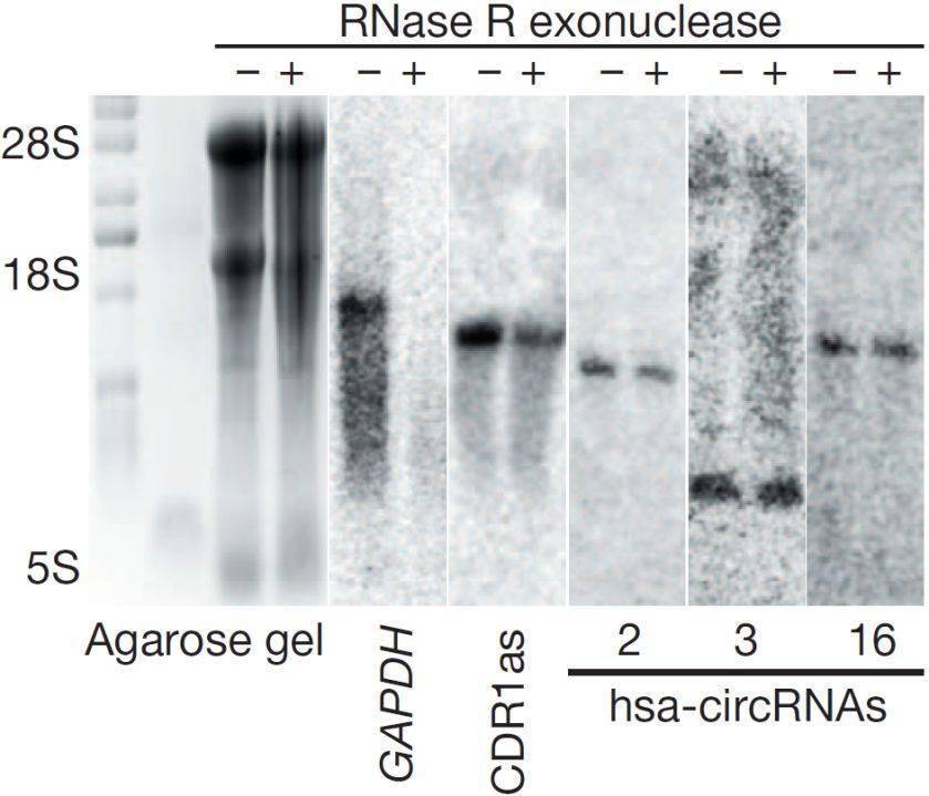 干货：RNase R使用攻略_circRNA