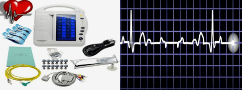 是时候搞清楚ECT、ETC、ECG了！_检查