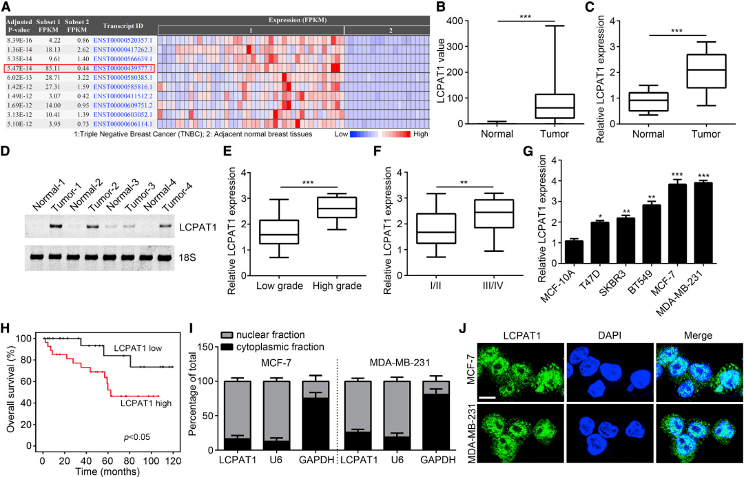 文献解读|定位于细胞核的lncRNA LCPAT1是如何促进乳腺癌的发展-搜狐大视野-搜狐新闻