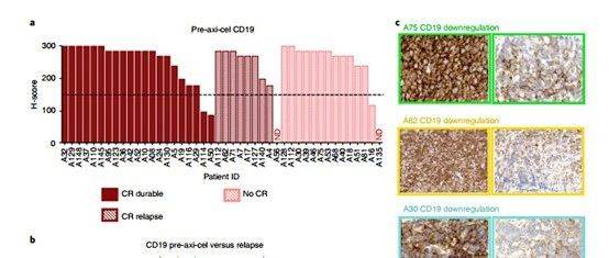 CD19-CD22 CAR-T细胞疗法的临床I期介绍_进展
