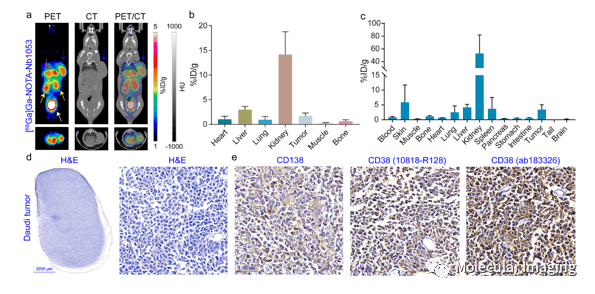 【学术】EJNMMI｜⁶⁸Ga-NOTA-Nb1053多发性骨髓瘤免疫PET成像_肿瘤_进行_探针