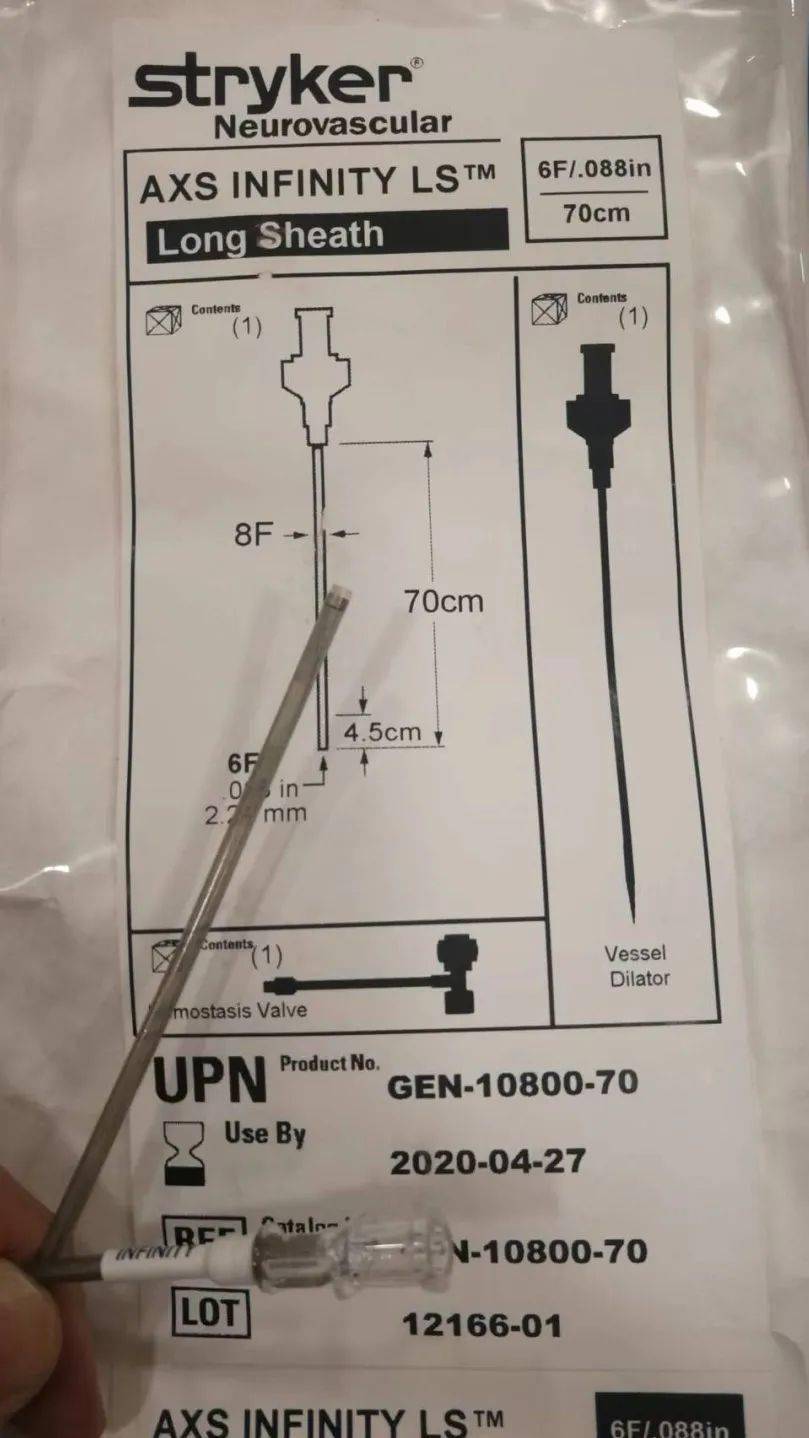 术说·第十七期丨Infinity长鞘助力Surpass Streamline血流导向密网支架治疗双侧颈内迂曲路径动脉瘤一例_手术_脑血管_基础