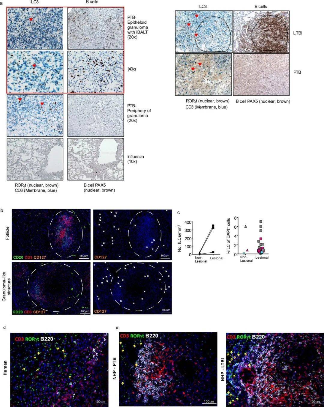 Nature| 免疫细胞在结核杆菌感染过程中的作用_组织_Mtb_样本