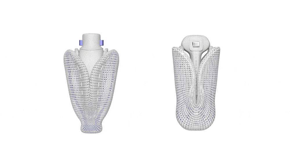 爱德华PASCAL Precision：获得FDA批准进行二尖瓣介入治疗_Pascal_系统_患者