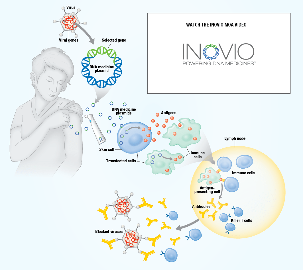 VGX-3100 III期临床再获突破，宫颈癌前病变首个DNA疗法还会远吗？_治疗_Inovio_细胞