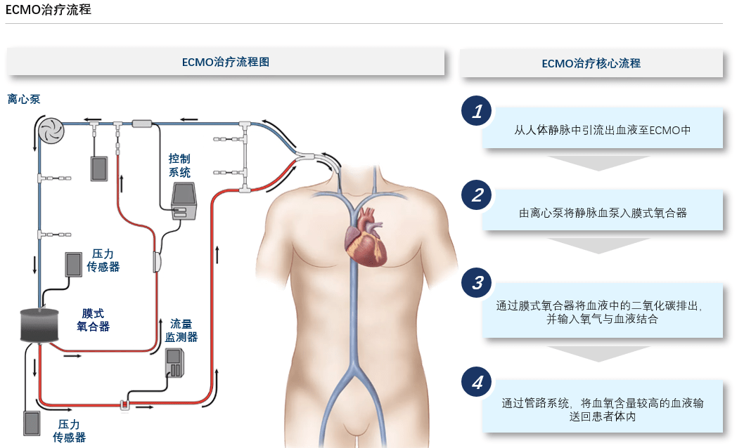 沙利文发布《ECMO行业现状与发展趋势报告》（内附全文获取方式）_应用_支持_临床
