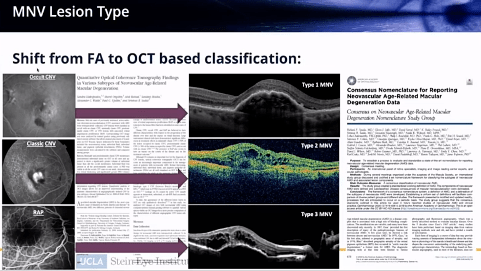 能够预测DME和nAMD治疗效果的生物标志物有哪些？且听SriniVas Sadda教授细说详解_患者_Type_预后